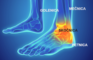 Poškodba gležnja je pogosta v športu in vsak dan. Vzroki, celjenje in vaje.